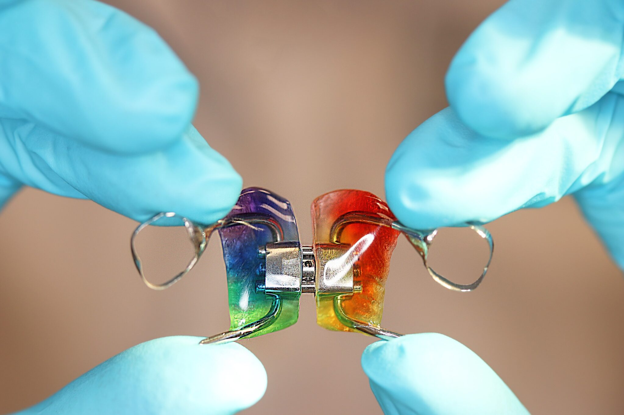 Orthodontic Expanders | Franklin Orthodontic Center | Orthodontist